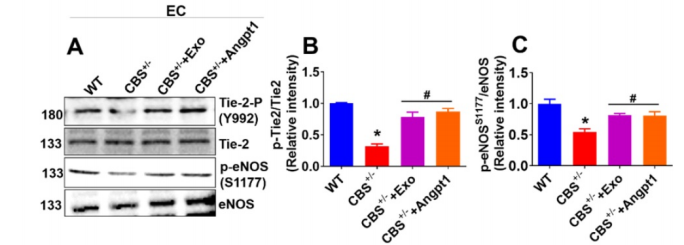 外泌体来源长链非编码RNA H19促进成骨和血管生成-上海优宁维生物科技股份有限公司