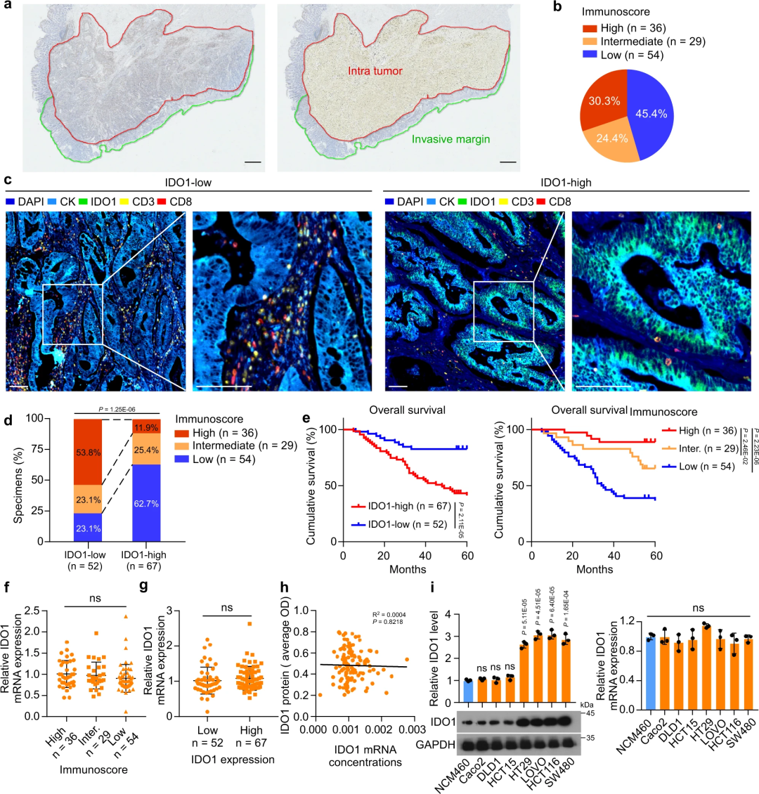 HALO助力结直肠癌免疫治疗靶点研究