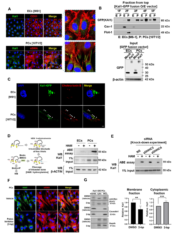 Advanced Science|皮肤类器官治疗局限性硬皮样病