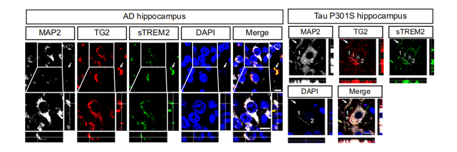 文献解析 | sTREM2有望改善AD患者的tau磷酸化和认知障碍