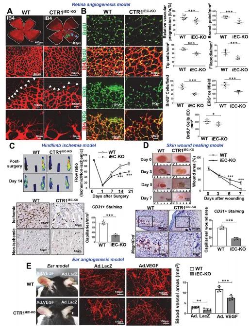 文献解析 | 铜转运蛋白CTR1半胱氨酸氧化驱动VEGFR2信号及血管生成新机制