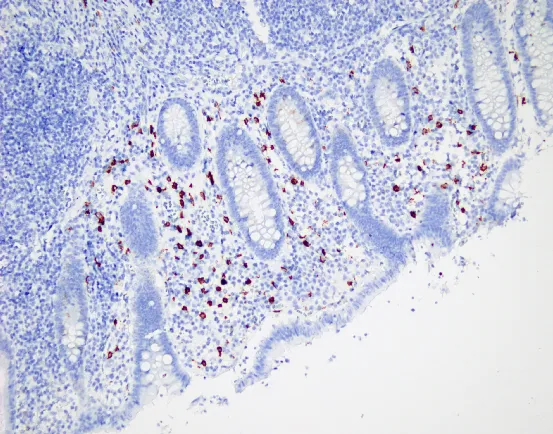 免疫组化中抗体 CD117 的质量把控