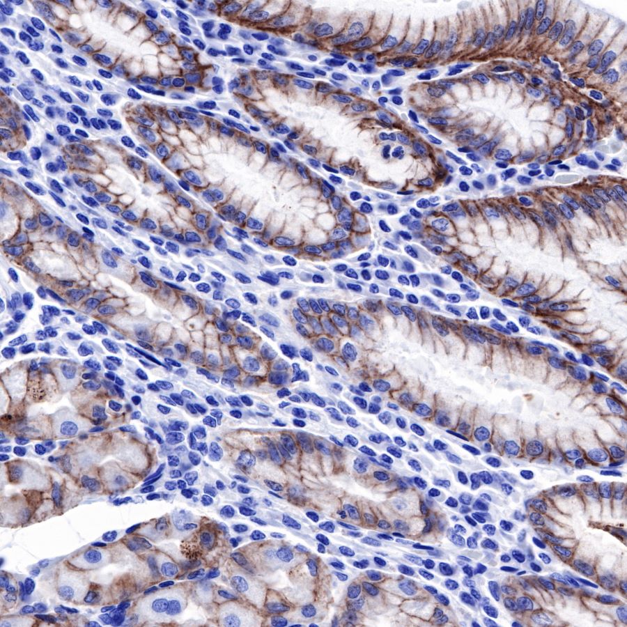 免疫组化（IHC）技术在临床诊断与治疗中的应用探索