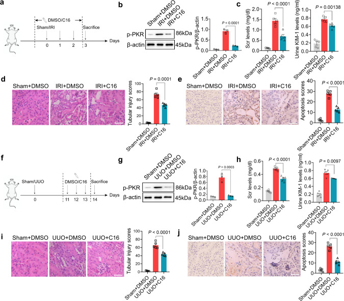 文献解析|多核苷酸磷酸化酶通过阻断mt-dsRNA-PKR-eIF2α轴保护肾小管免受损伤