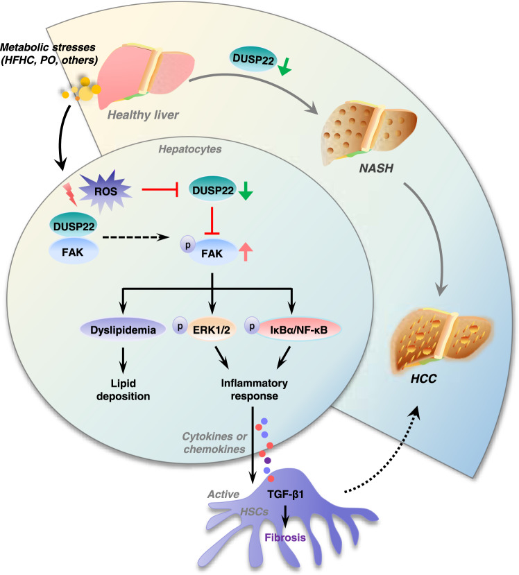 文献解析|双特异性磷酸酶22（DUSP22）抑制非酒精性脂肪性肝炎（NASH）发展为肝细胞癌（HCC）的机制研究