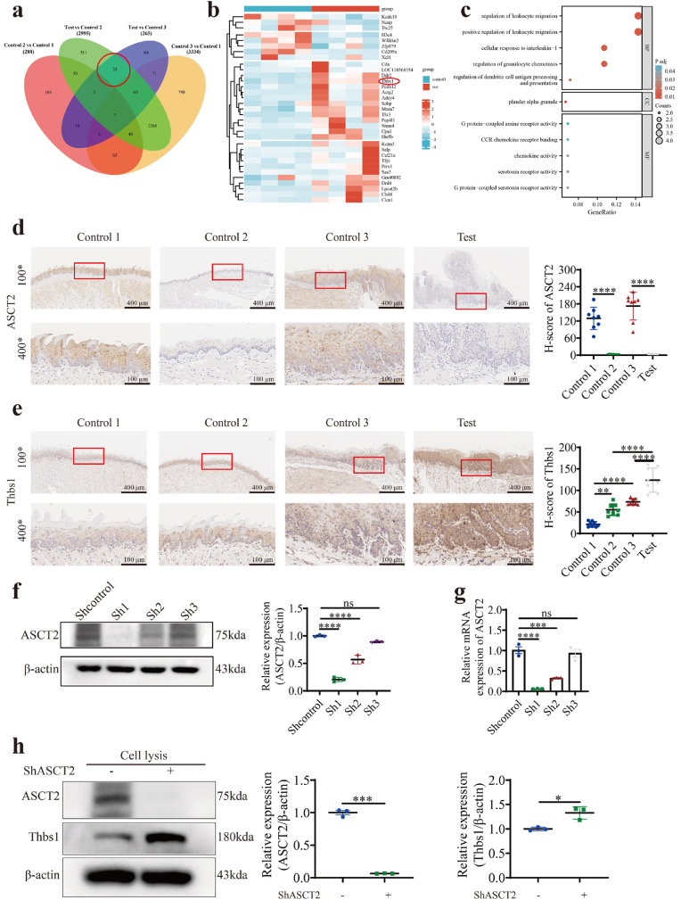 文献解析|氧化应激通过Thbs1介导的M1样肿瘤相关巨噬细胞极化促进口腔癌变-上海优宁维生物科技股份有限公司