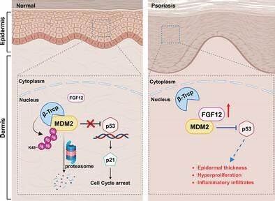 成纤维细胞生长因子12（FGF12）在肝脏纤维化中的作用及机制研究 -斯达特(Starter),国产抗体专家
