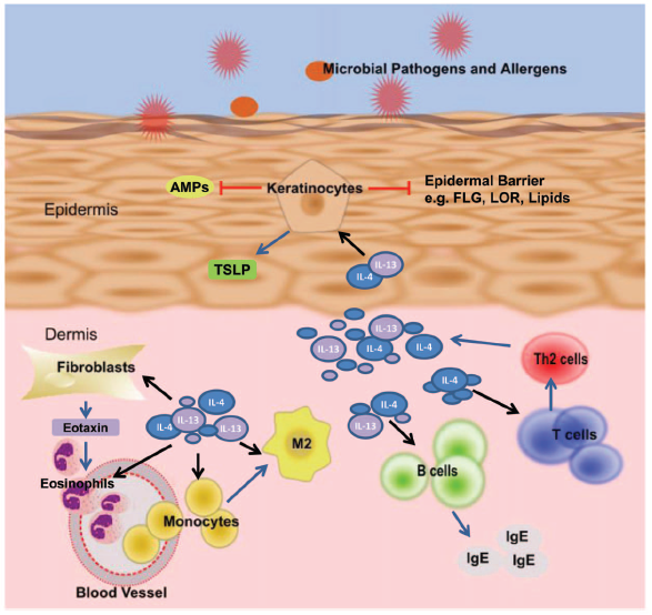 IL-4诱导的M2INF巨噬细胞在二型免疫疾病及感染防御中的机制研究
